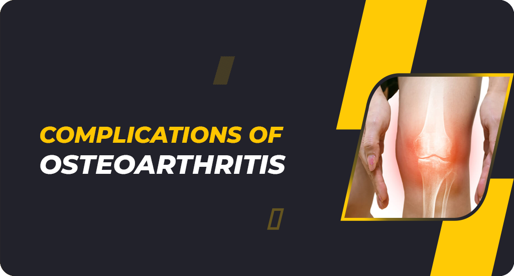 COMPLICATIONS OF OSTEOARTHRITIS