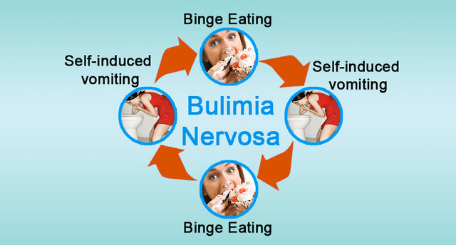 BULIMIA NERVOSA (BN) – Steadfast Nutrition